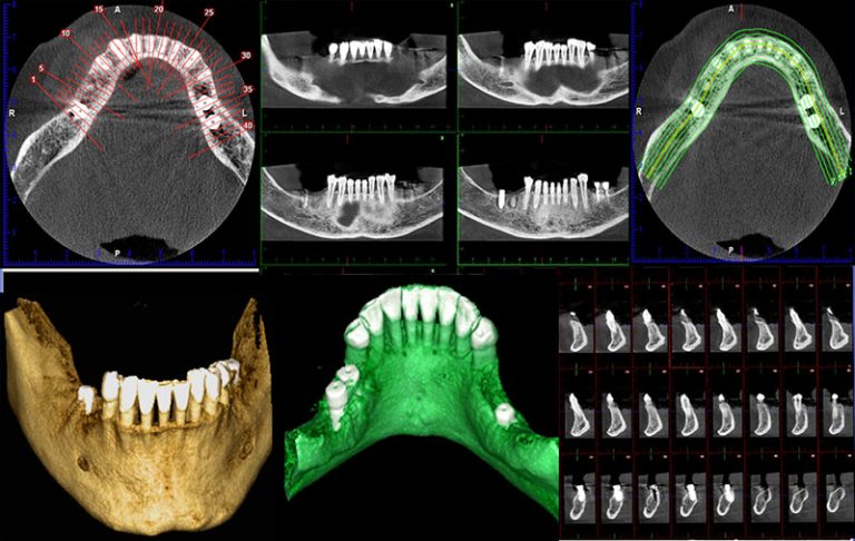 Dentascan ortopantomografo - Salus Belluno